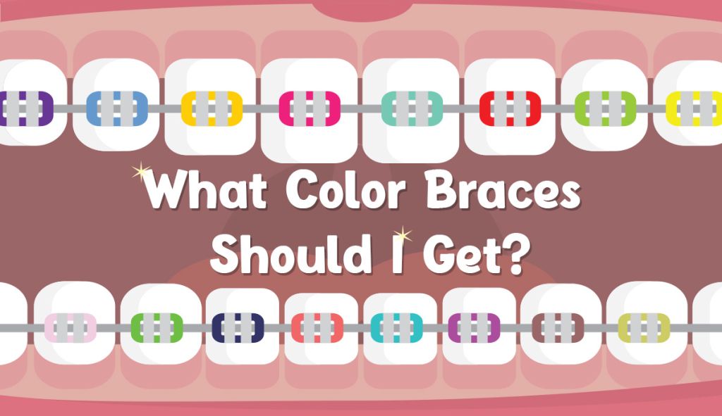 Braces Color Selector For Girls