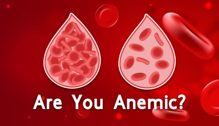 Quiz: Am I Anemic? Let's Analyze 20 Symptom to Find Out